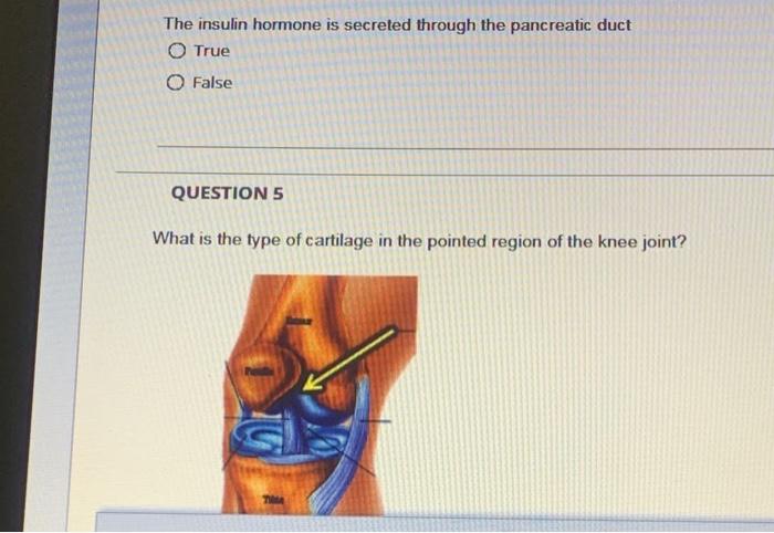 Solved QUESTION 10 Amphioxus has which type of body coelom? | Chegg.com