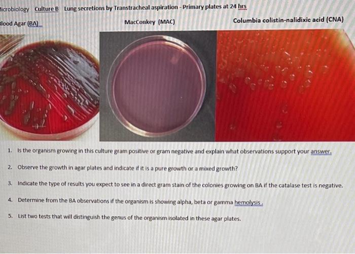 Solved Microbiology Culture B Lung secretions by | Chegg.com