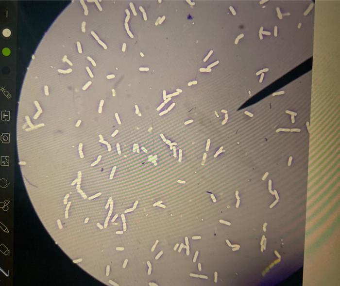 Solved 2. Sketch few bacteria viewed with the oil immersion | Chegg.com