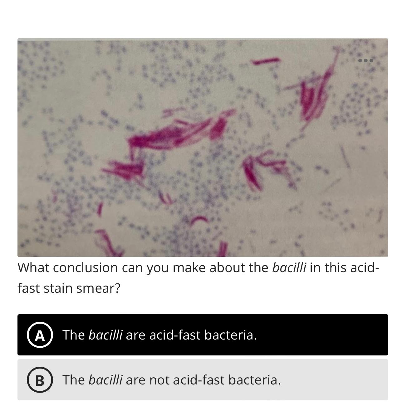 Solved What conclusion can you make about the bacilli in | Chegg.com