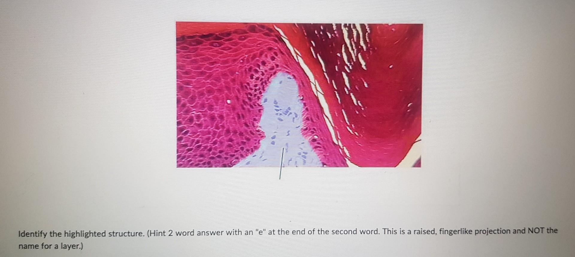 Solved Identify the highlighted structure. (Hint 2 word | Chegg.com