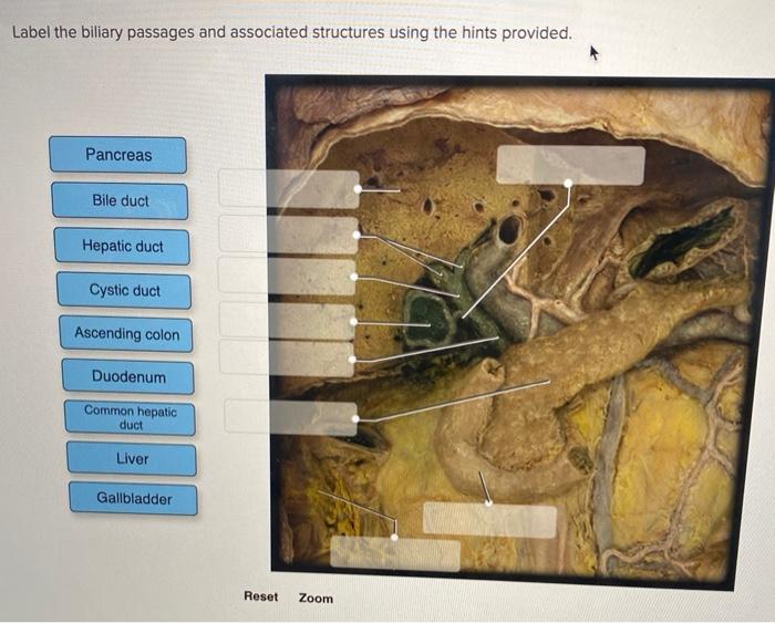 Solved Label the biliary passages and associated structures | Chegg.com