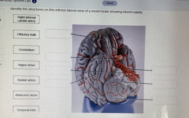 Solved identify the structures of this inferior lateral view | Chegg.com