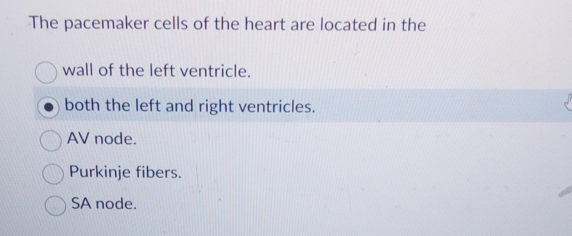 Solved The pacemaker cells of the heart are located in the | Chegg.com