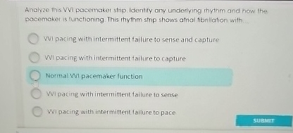 Solved Analyze this VVI pacemaker strip. Identify ary | Chegg.com