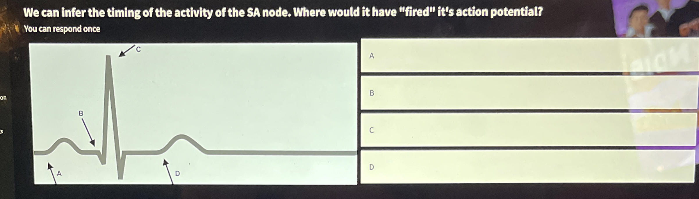 Solved We can infer the timing of the activity of the SA | Chegg.com
