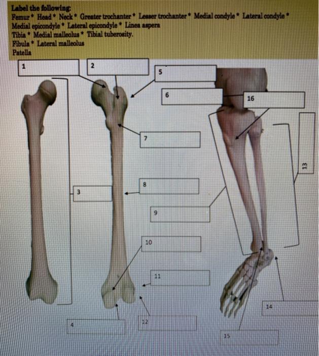 Solved Label the following Scapula Spine Coracoid proces | Chegg.com