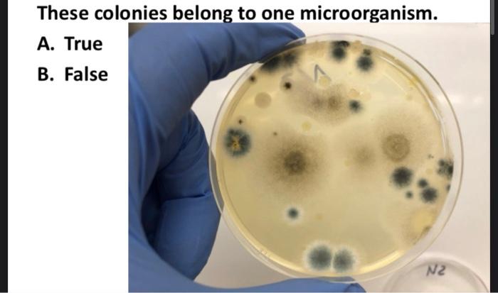 Solved 8. Most of pure colonies are in area A. 1 B. 2 C. 3 | Chegg.com