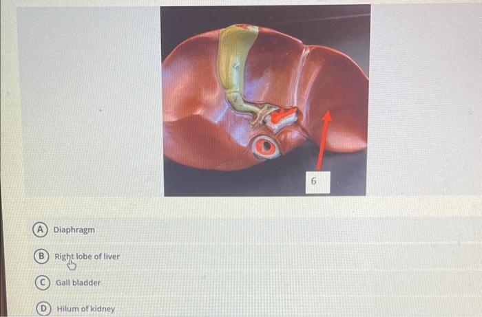 Solved Diaphragm Right lobe of liver Gall bladder Hilum of | Chegg.com