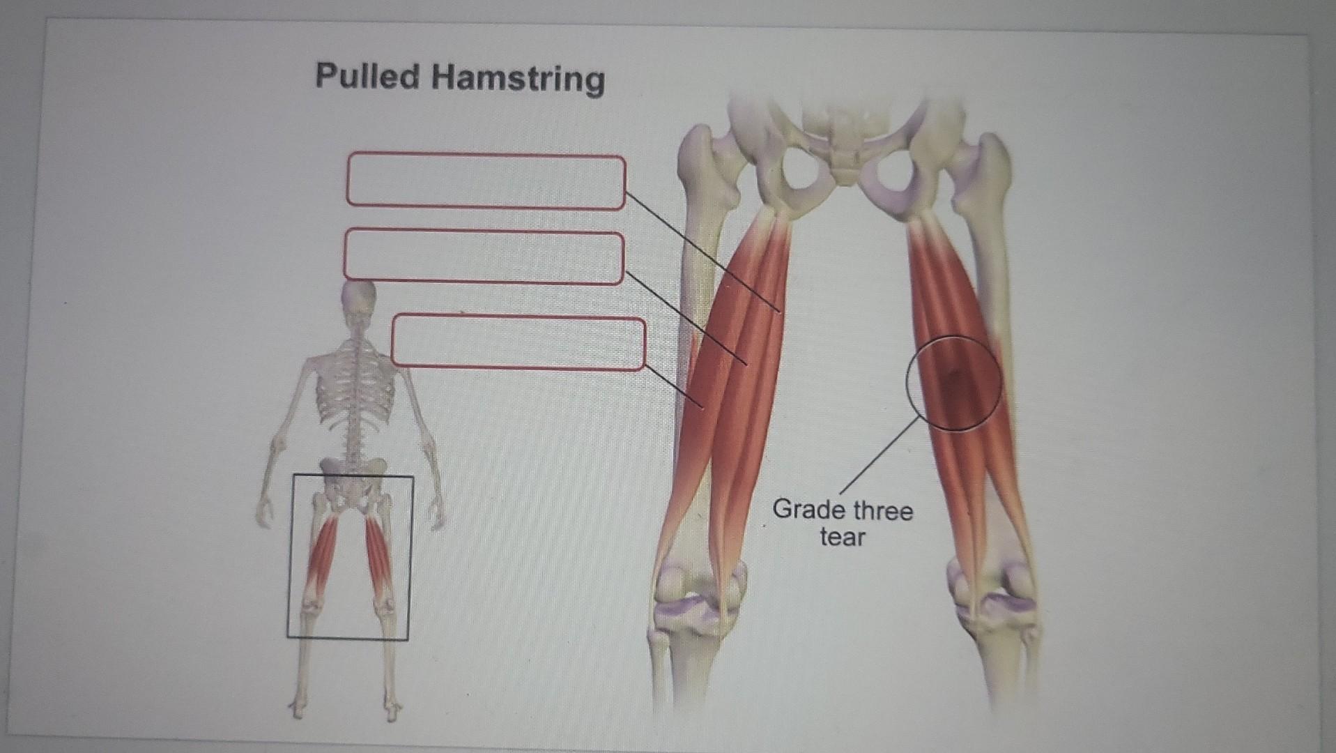 Pulled Hamstring ...and finally, a very special | Chegg.com