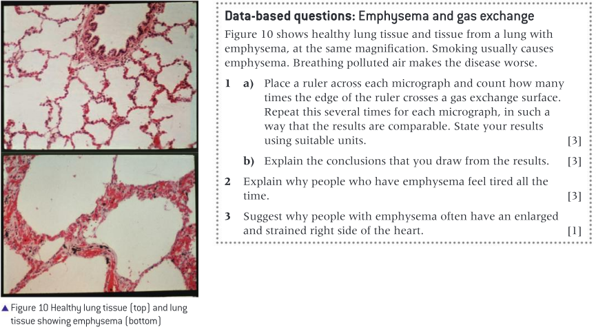 Solved Data-based questions: Emphysema and gas | Chegg.com