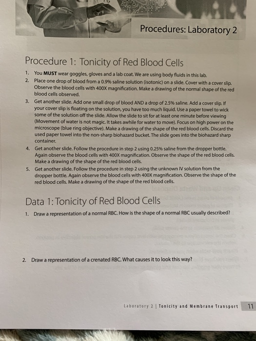 Solved Procedures: Laboratory 2 Procedure 1: Tonicity of Red | Chegg.com