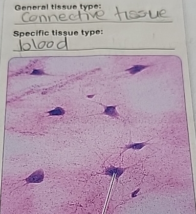 General tissue type:Connective tissueSpecific tissue | Chegg.com