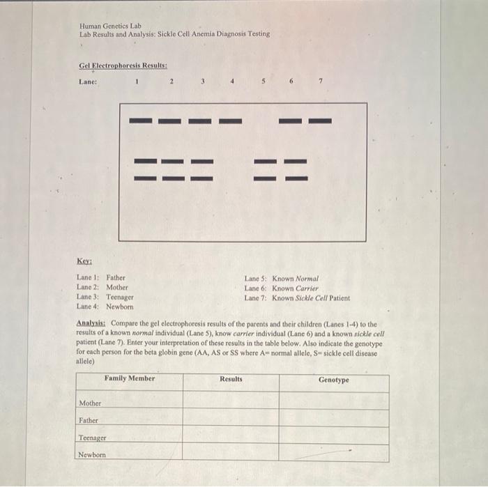 Solved Human Genetics Iab Lab Results and Analysis: Sickle | Chegg.com