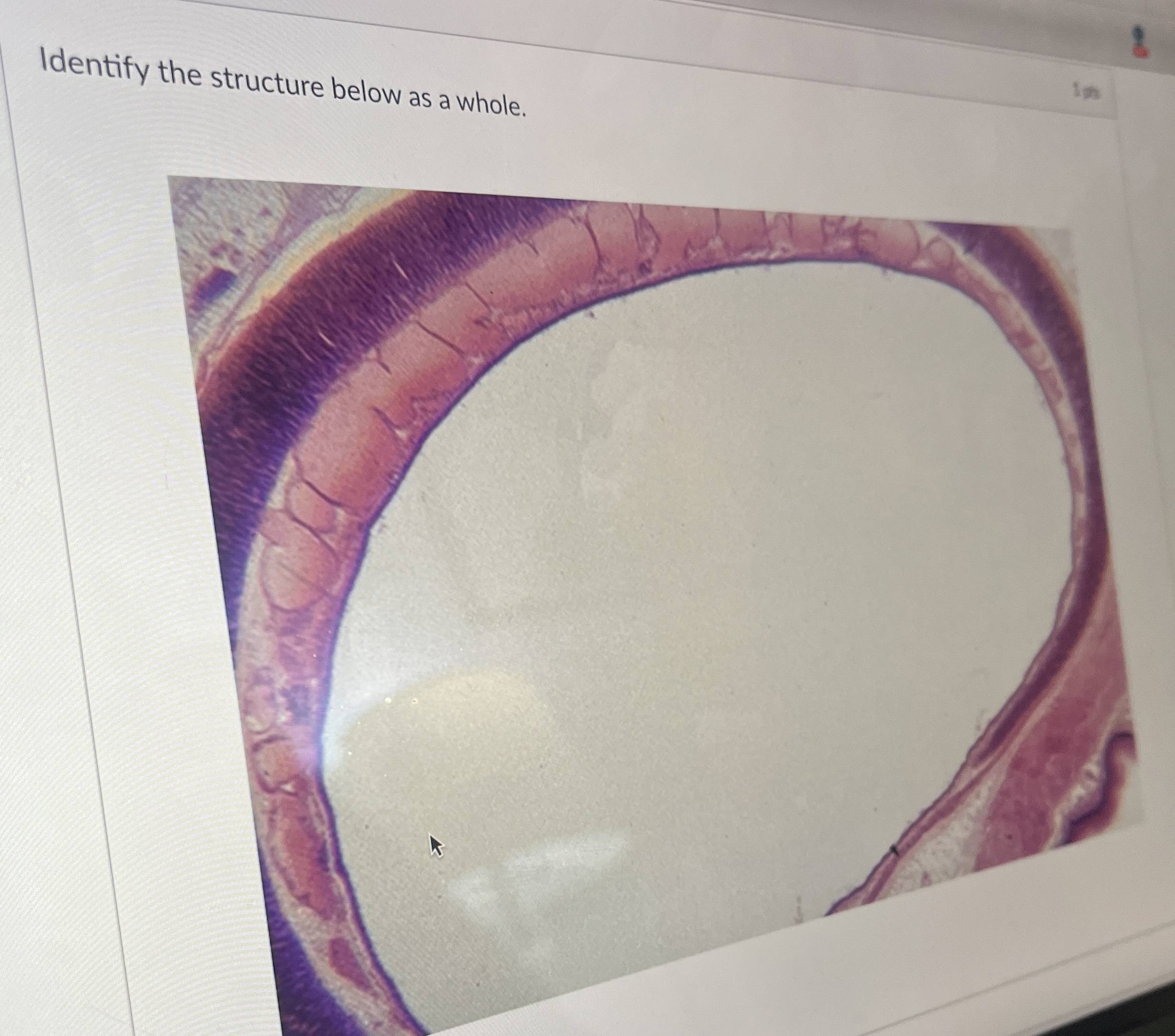Solved Identify the structure below as a whole.In | Chegg.com