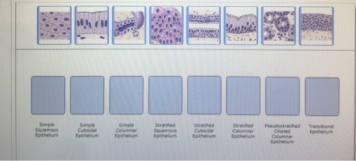 Solved Simple Squamous Epithelium Simple Cuboidal Epithelium | Chegg.com