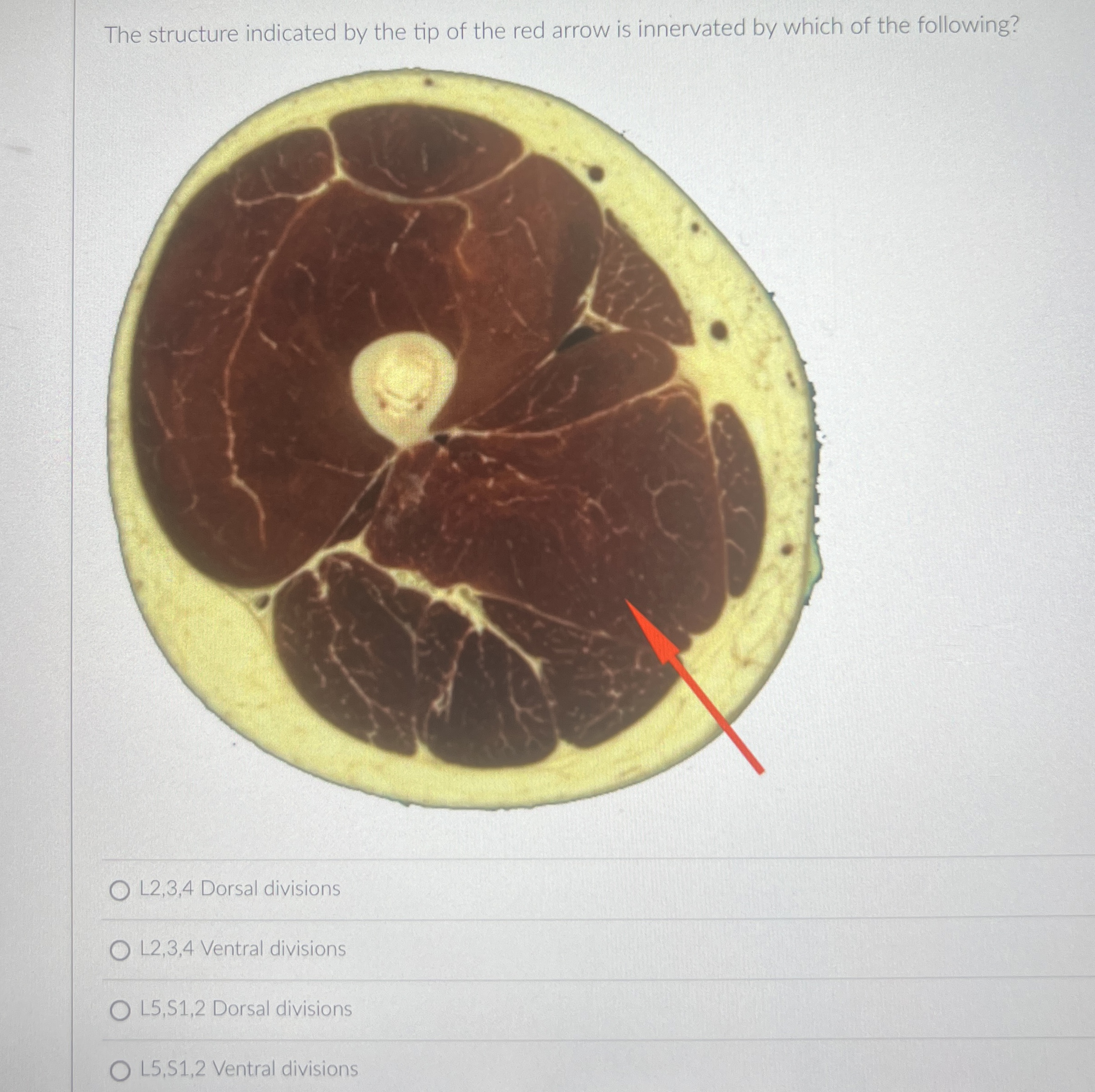 Solved The structure indicated by the tip of the red arrow | Chegg.com