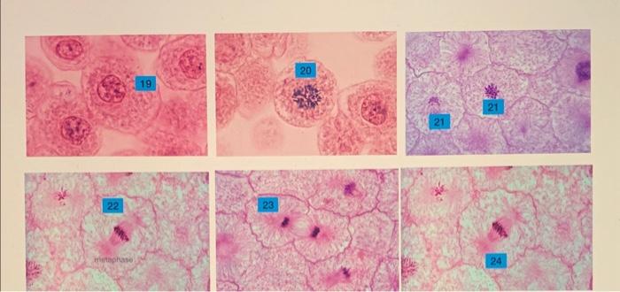 Solved cell division- label it | Chegg.com