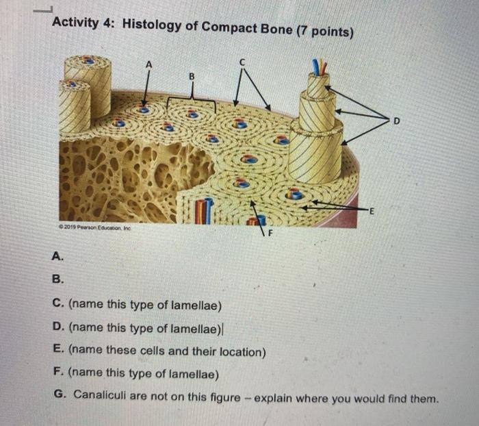 Solved Activity 4 - Histology of Compact Bone On a figure of | Chegg.com