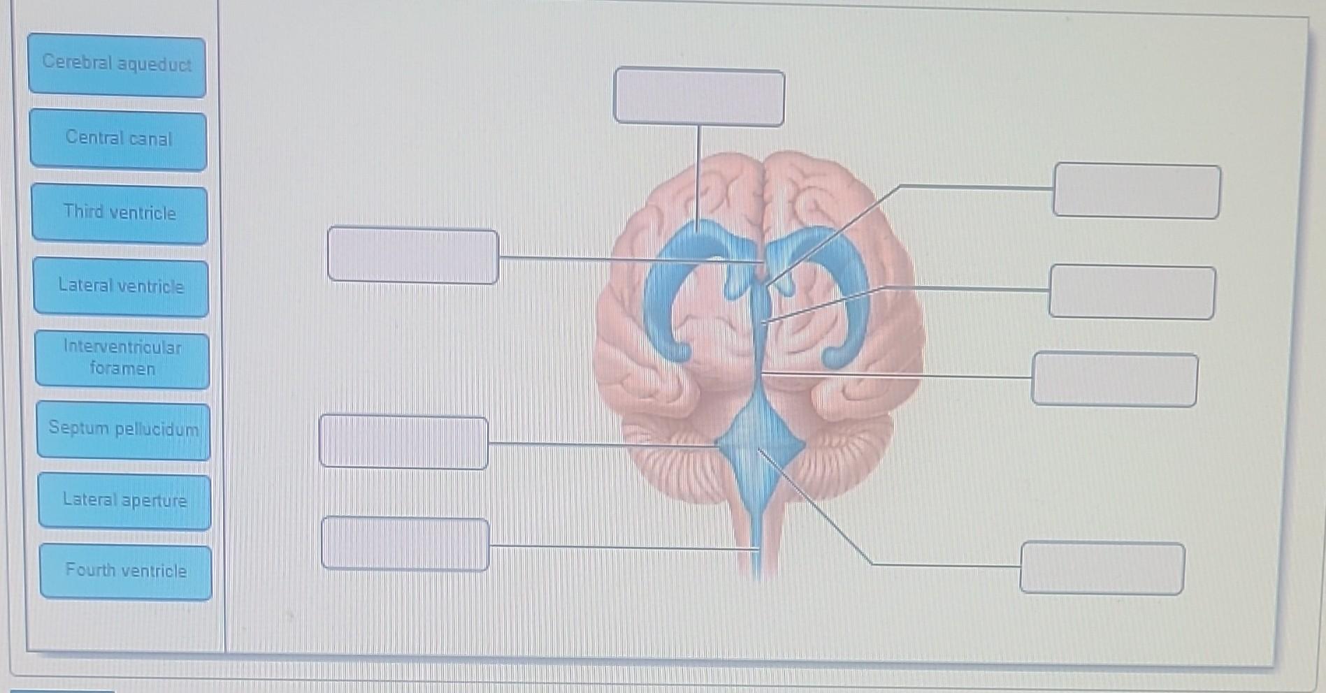 Solved help label.. | Chegg.com