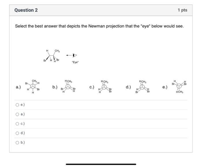 Solved Select the best answer that depicts the Newman | Chegg.com