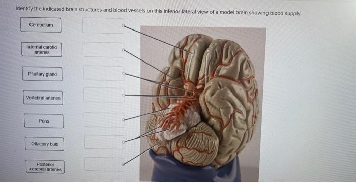 Solved Identify the structures this midsagittal view of a | Chegg.com Solved Identify the structures this midsagittal view of a | Chegg.com