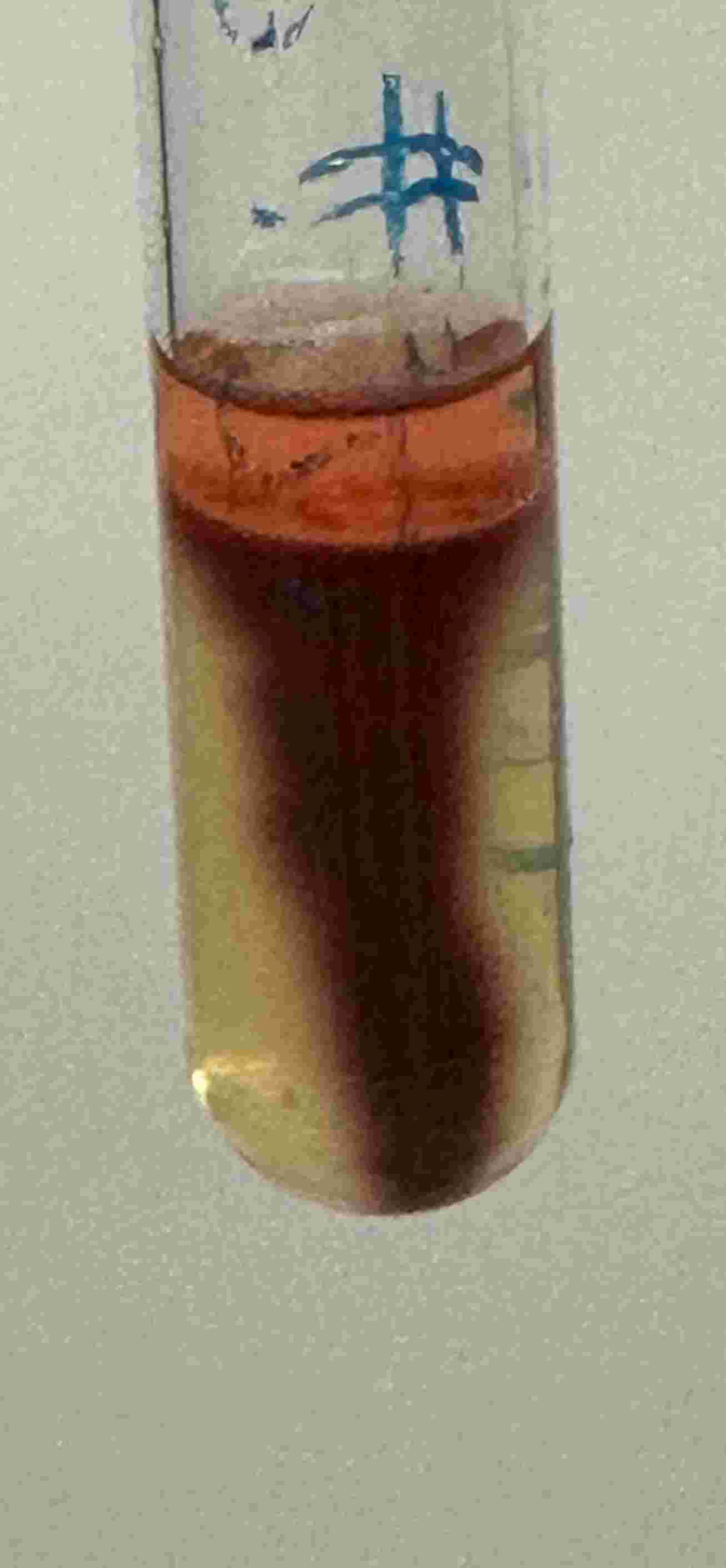 Solved Is this SIM tube positive for Hydrogen sulfide, | Chegg.com