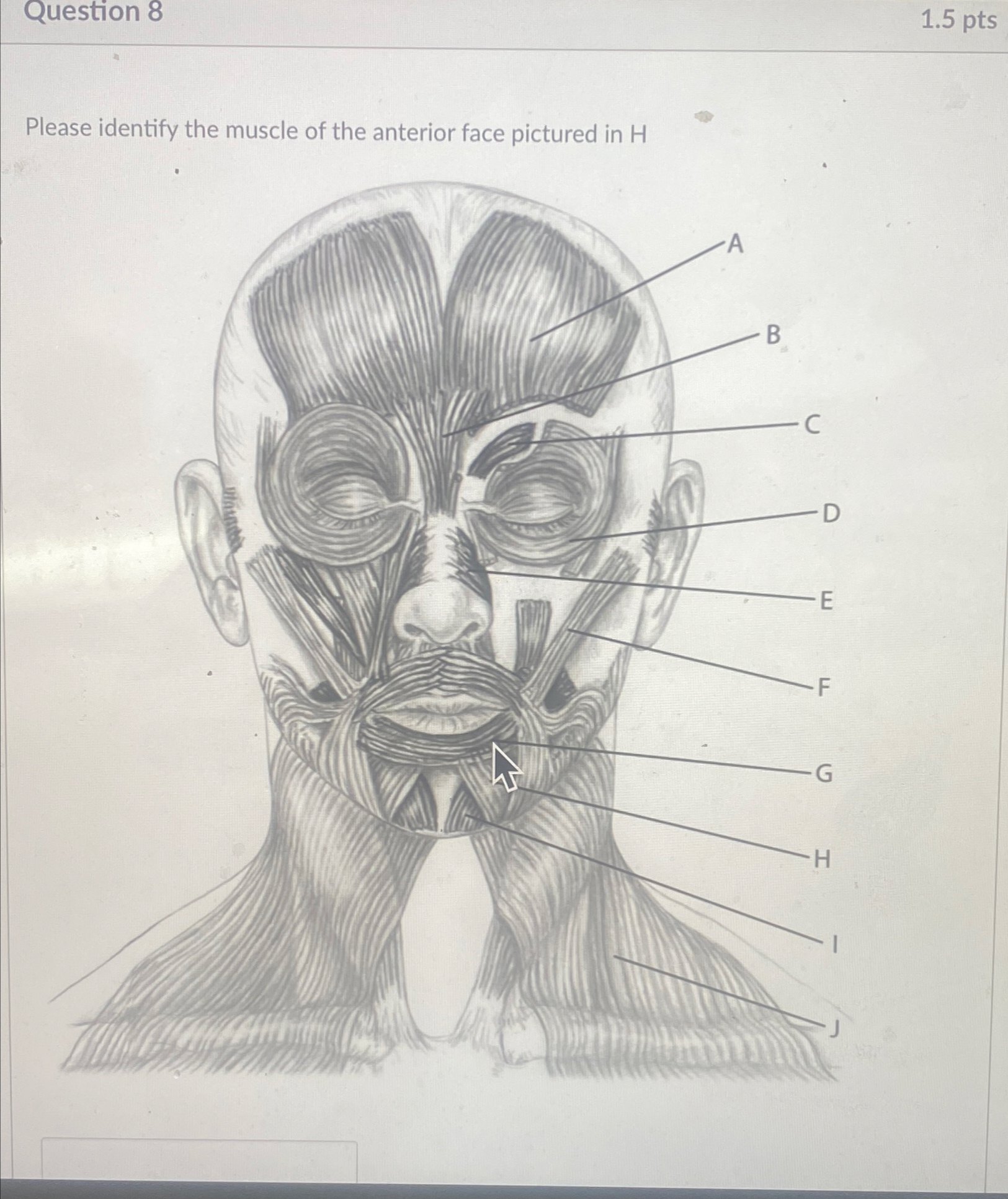 Solved Question 81.5ptsPlease identify the muscle of the | Chegg.com