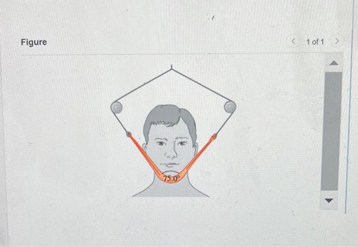Solved Due to a jaw injury, a patient must wear a strap | Chegg.com