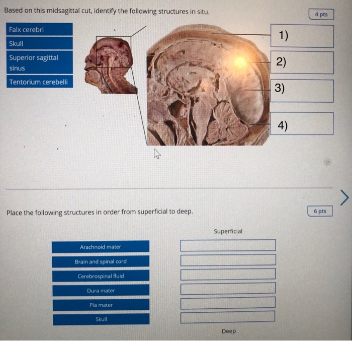 Solved Based on this midsagittal cut, identify the following | Chegg.com
