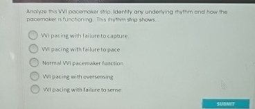 Solved Analyze this VVI pacemaker strip. Identify amy | Chegg.com
