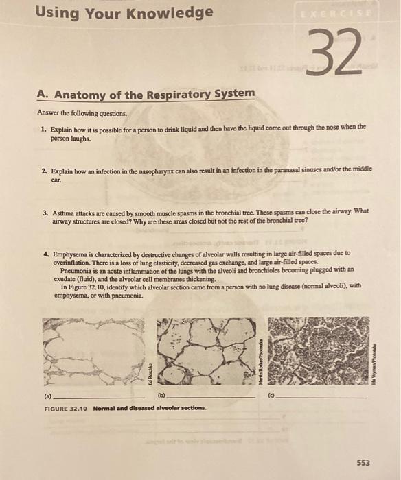 Solved Using Your Knowledge KECS 32 A. Anatomy of the | Chegg.com