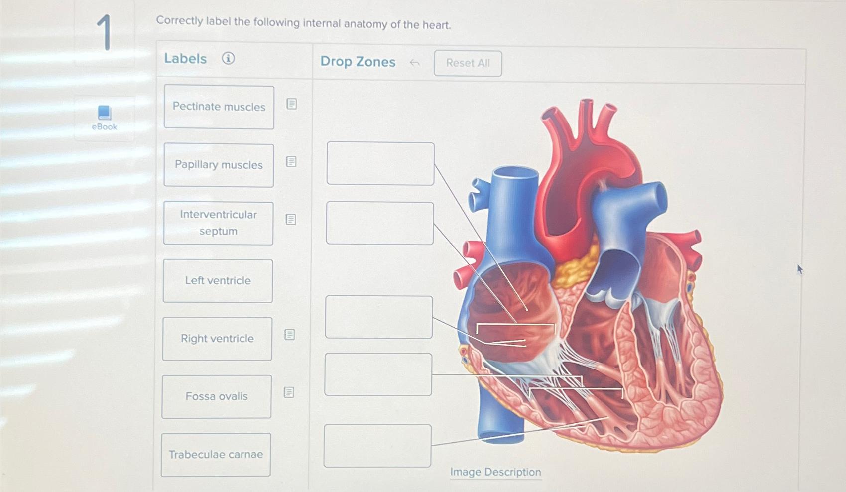 Solved 1 ﻿Correctly label the following internal anatomy of | Chegg.com