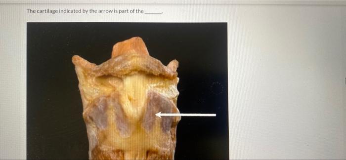 Solved +7 0.5 !! At the the structure indicated by the arrow | Chegg.com