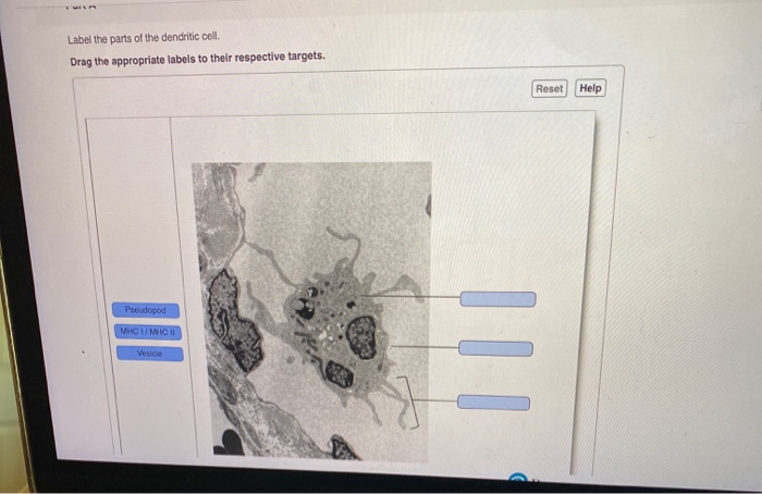 Solved Label the parts of the dendritic cell. Drag the | Chegg.com