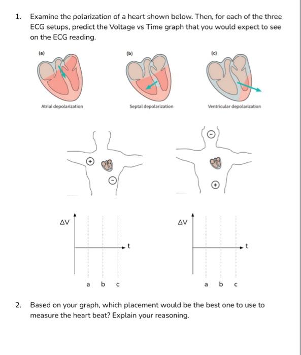 1. 2. Examine the polarization of a heart shown | Chegg.com