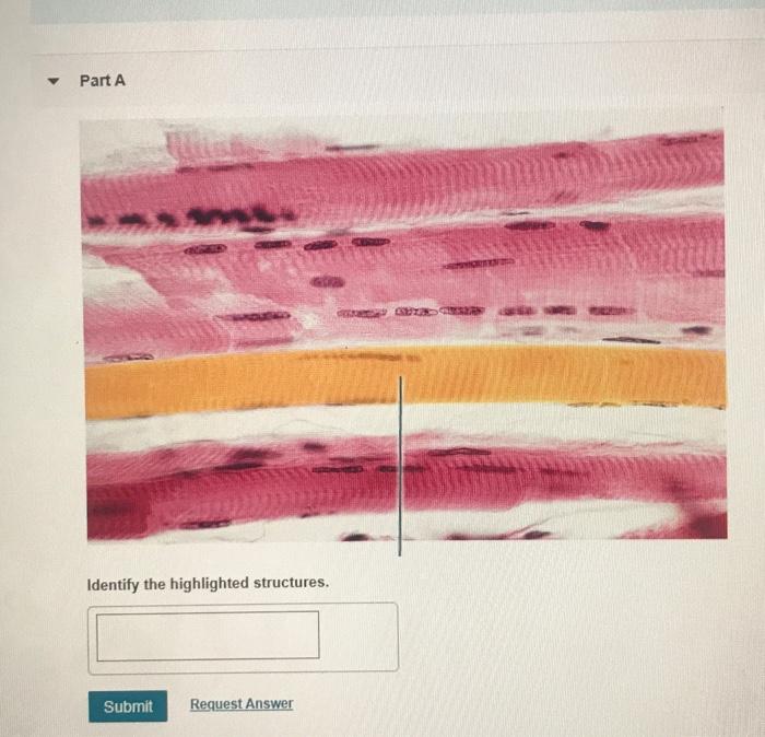 Solved Part A The GI tract has four distinct layers. Which | Chegg.com
