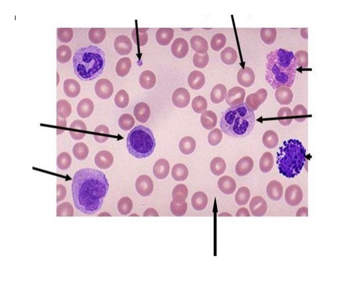 Solved On this blood smear slide document, label: | Chegg.com