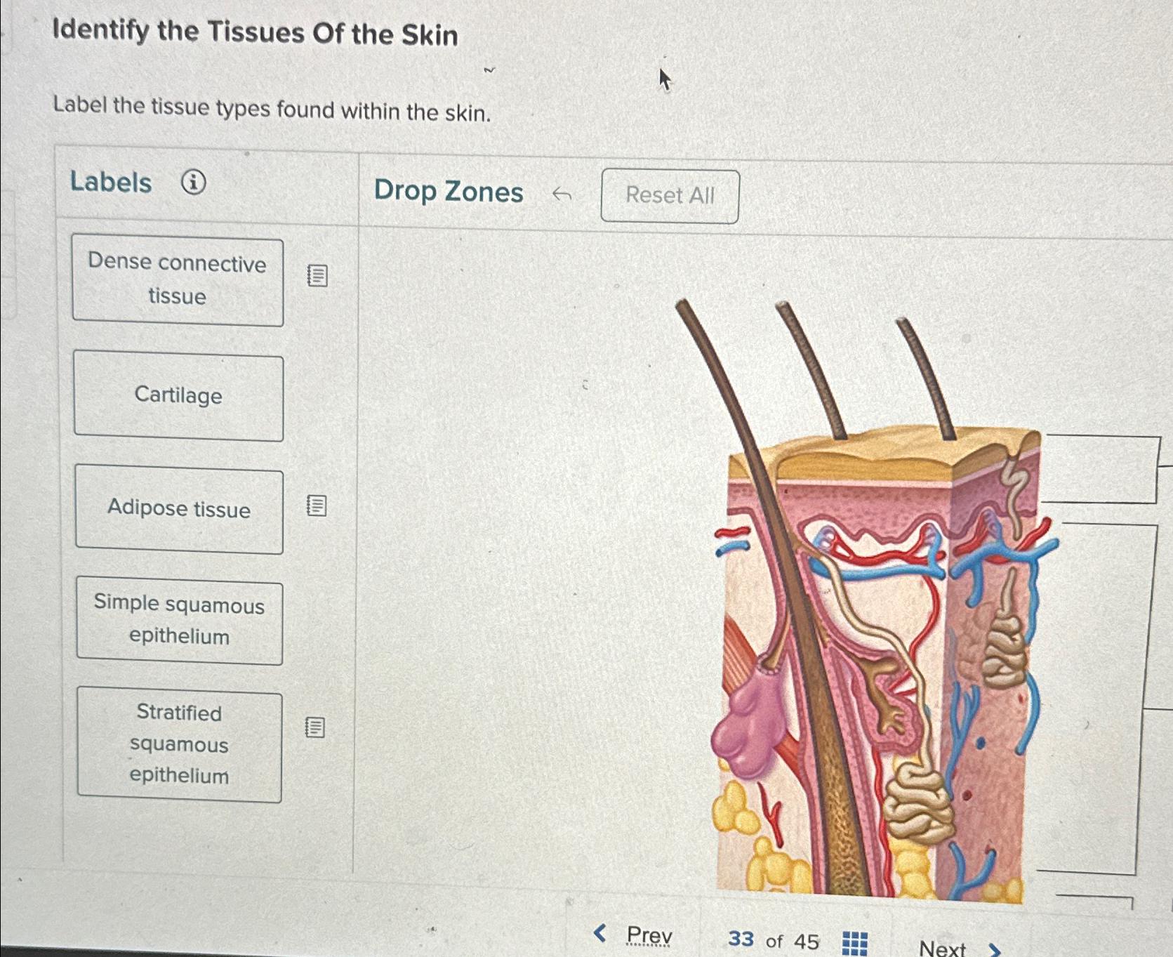 Solved Identify the Tissues Of the SkinLabel the tissue | Chegg.com