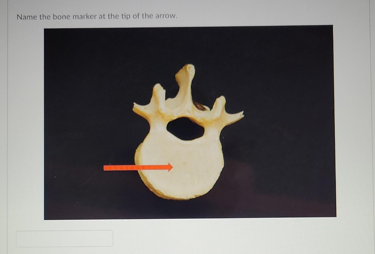 Solved Name the bone marker at the tip of the arrow. Name | Chegg.com