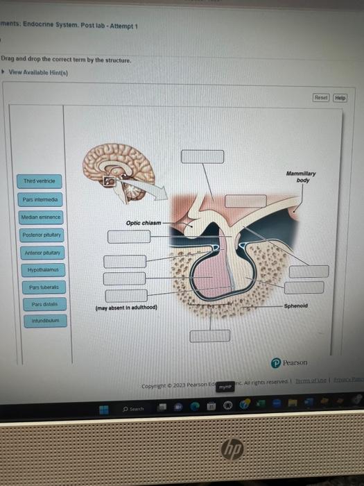 Solved Drag and drop the correct term by the structure. View | Chegg.com