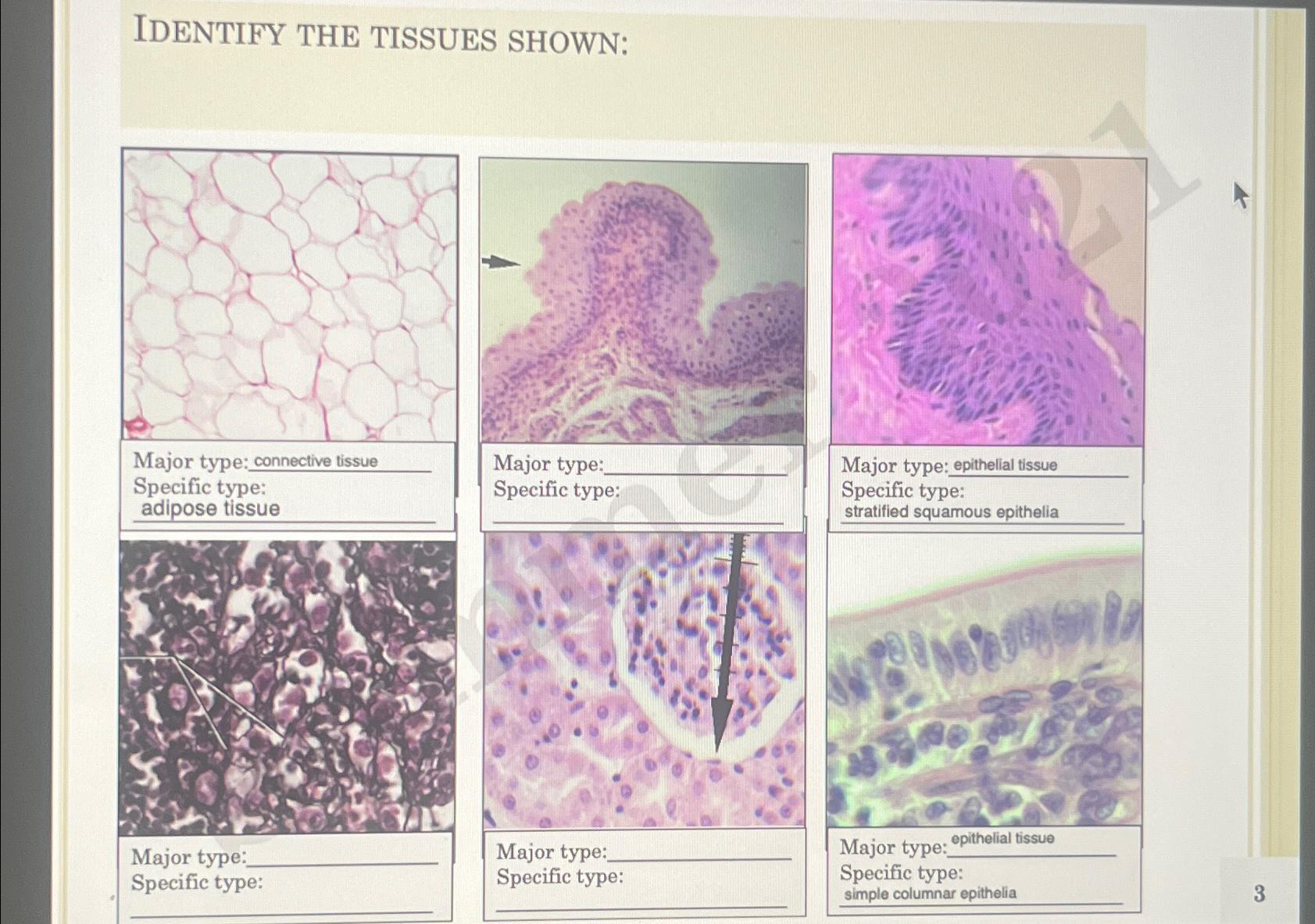 Solved IDENTIFY THE TISSUES SHOWN:Major type:co Specific | Chegg.com