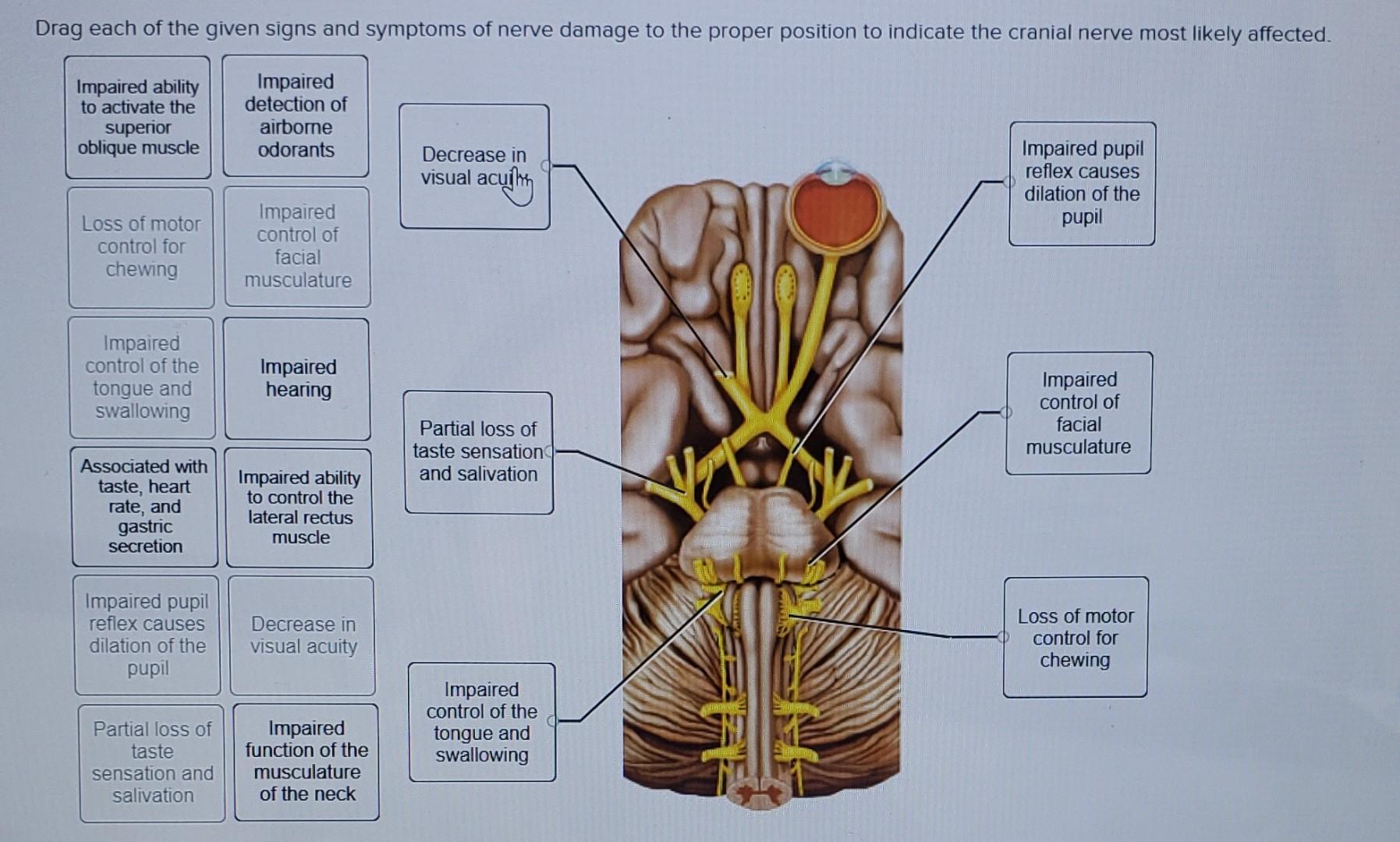 Solved Drag each of the given signs and symptoms of nerve | Chegg.com