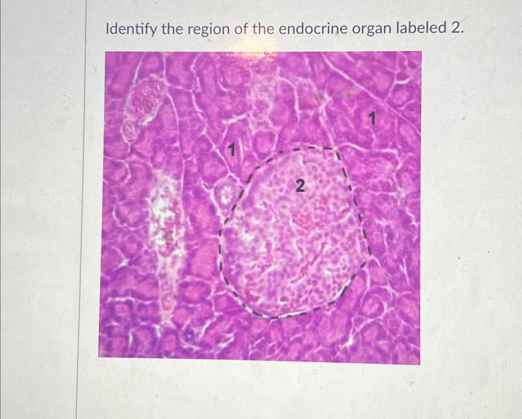 Solved Identify the region of the endocrine organ labeled 2. | Chegg.com