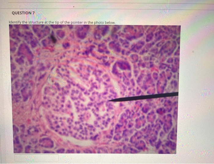 Solved Identify the structure at the tip of the pointer in | Chegg.com