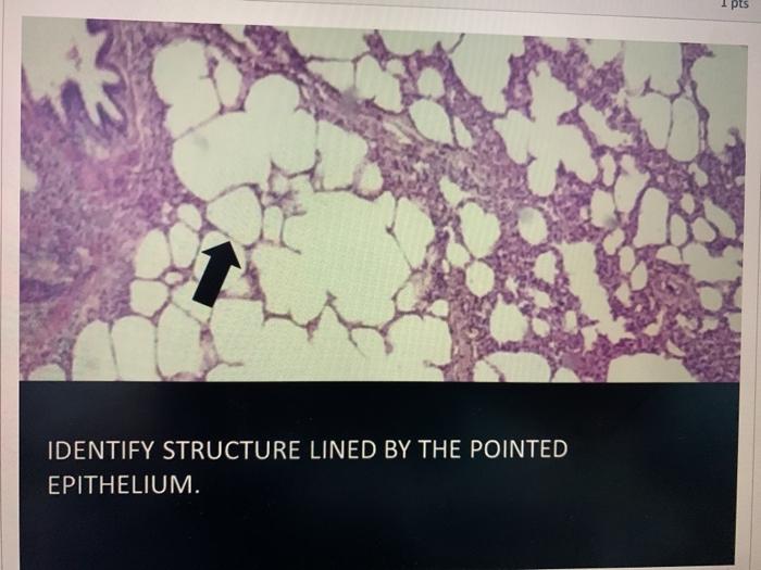 Solved IDENTIFY POINTED STRUCTURE WHAT STRUCTURE IS LINED | Chegg.com Solved IDENTIFY POINTED STRUCTURE WHAT STRUCTURE IS LINED | Chegg.com