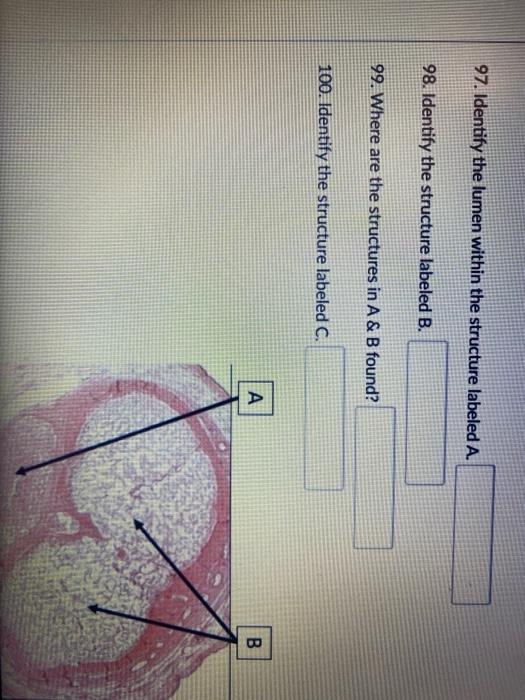 Solved 97. Identify the lumen within the structure labeled | Chegg.com