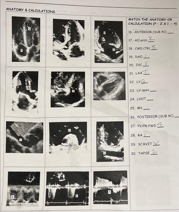 ANATOMY & CALCULATIONS MATCH THE ANATOMY OR | Chegg.com