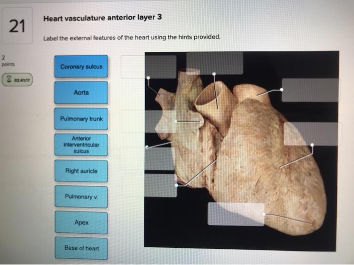 Solved Heart vasculature anterior layer 3 21 Label the | Chegg.com