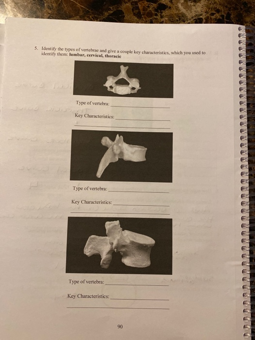 Solved 5. Identify the types of vertebrae and give a couple | Chegg.com